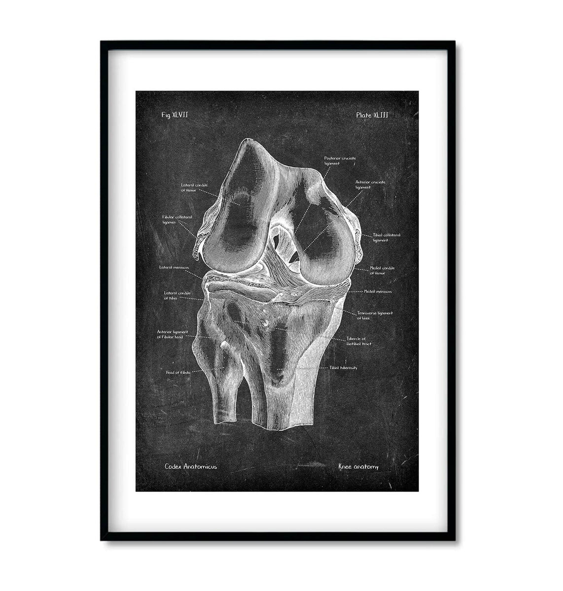 Knee Anatomy Art Set of 3 - Codex Anatomicus