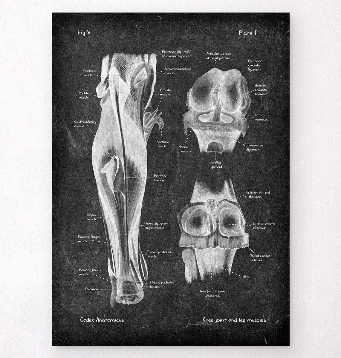 Knee joint and leg muscles - Chalkboard Style - Codex Anatomicus