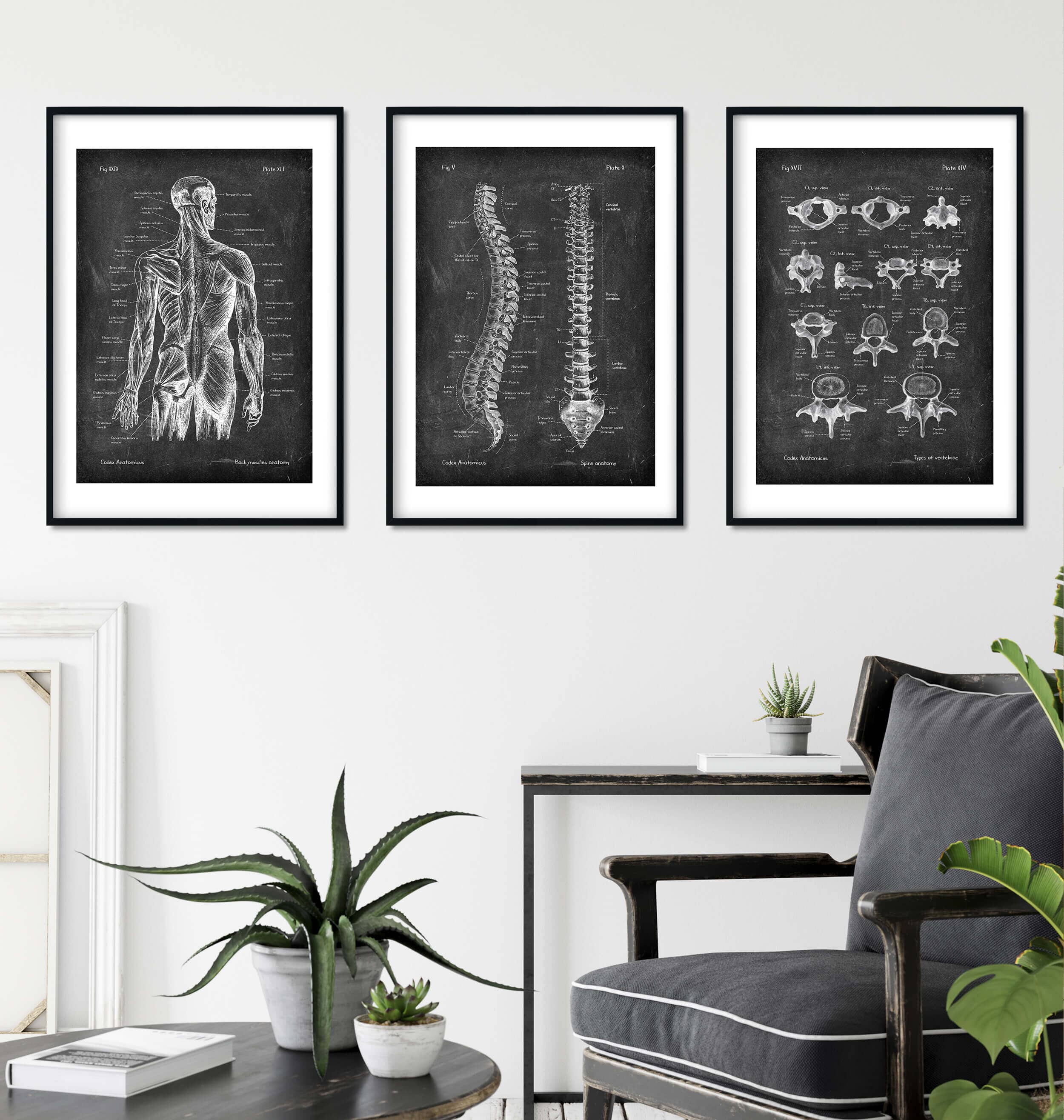 Spine & Back muscles Chalkboard Anatomy Art Set of 3 - Codex Anatomicus