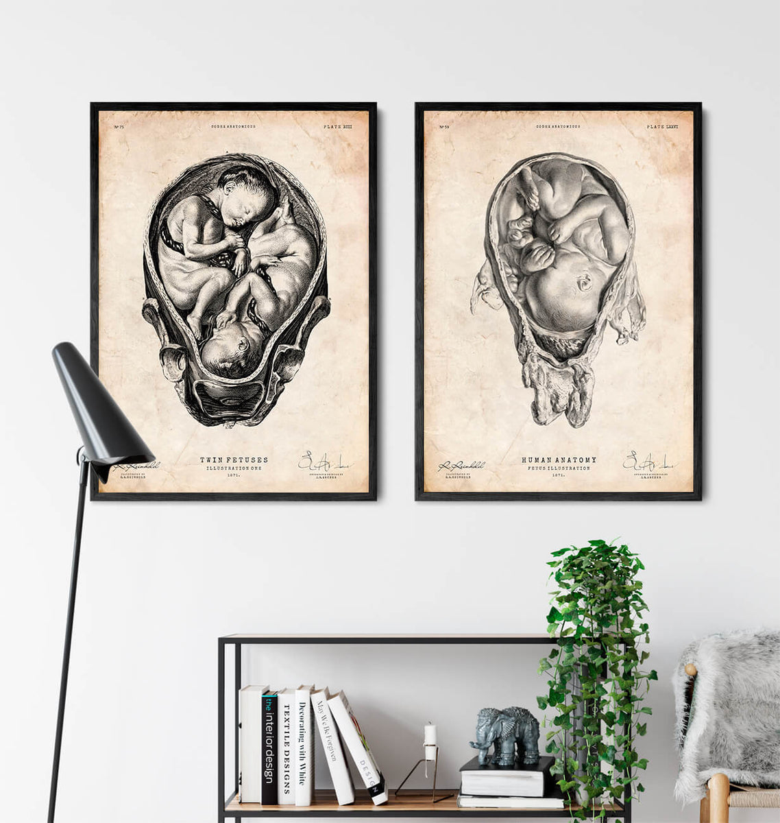 Womb anatomy poster - Codex Anatomicus